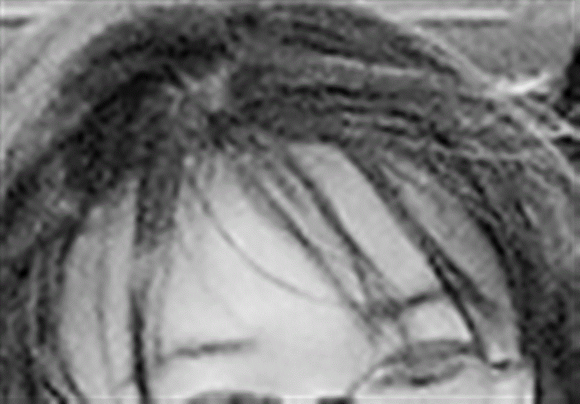 Martin Frankel Mansion