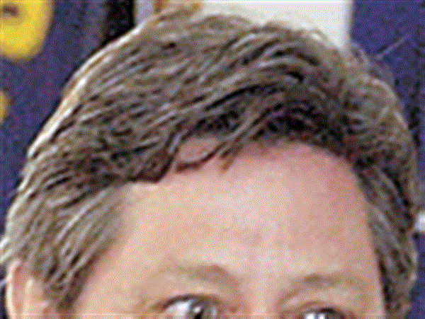 Gerken starts campaign for Lucas County commissioner | The Blade