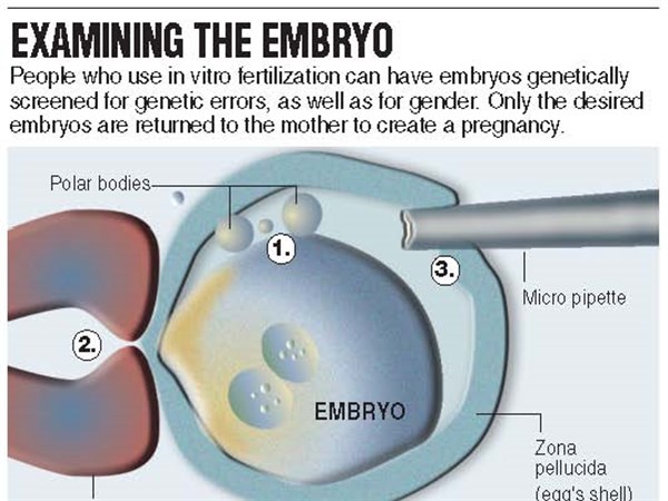 Embryo screening opens window of hope | The Blade