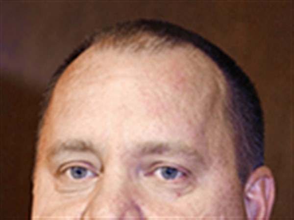 Michael P. McAlear (1960-2017) | The Blade