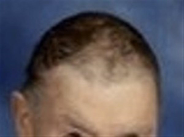 James Elmer Heider (1936-2018) | The Blade