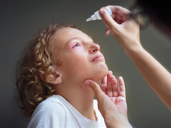 Within sight: Physicians discern the three causes of pink eye | The Blade